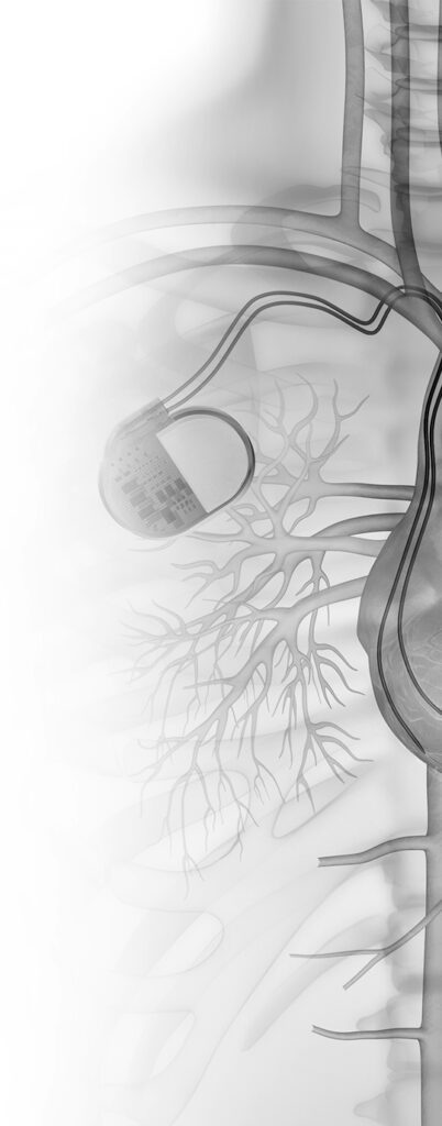 MedTech Markets We Serve - Resonetics