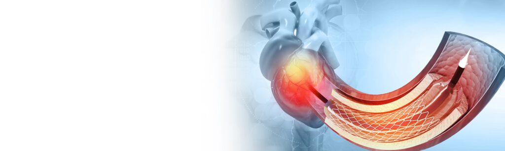 Interventional Medical Devices and Components - Resonetics