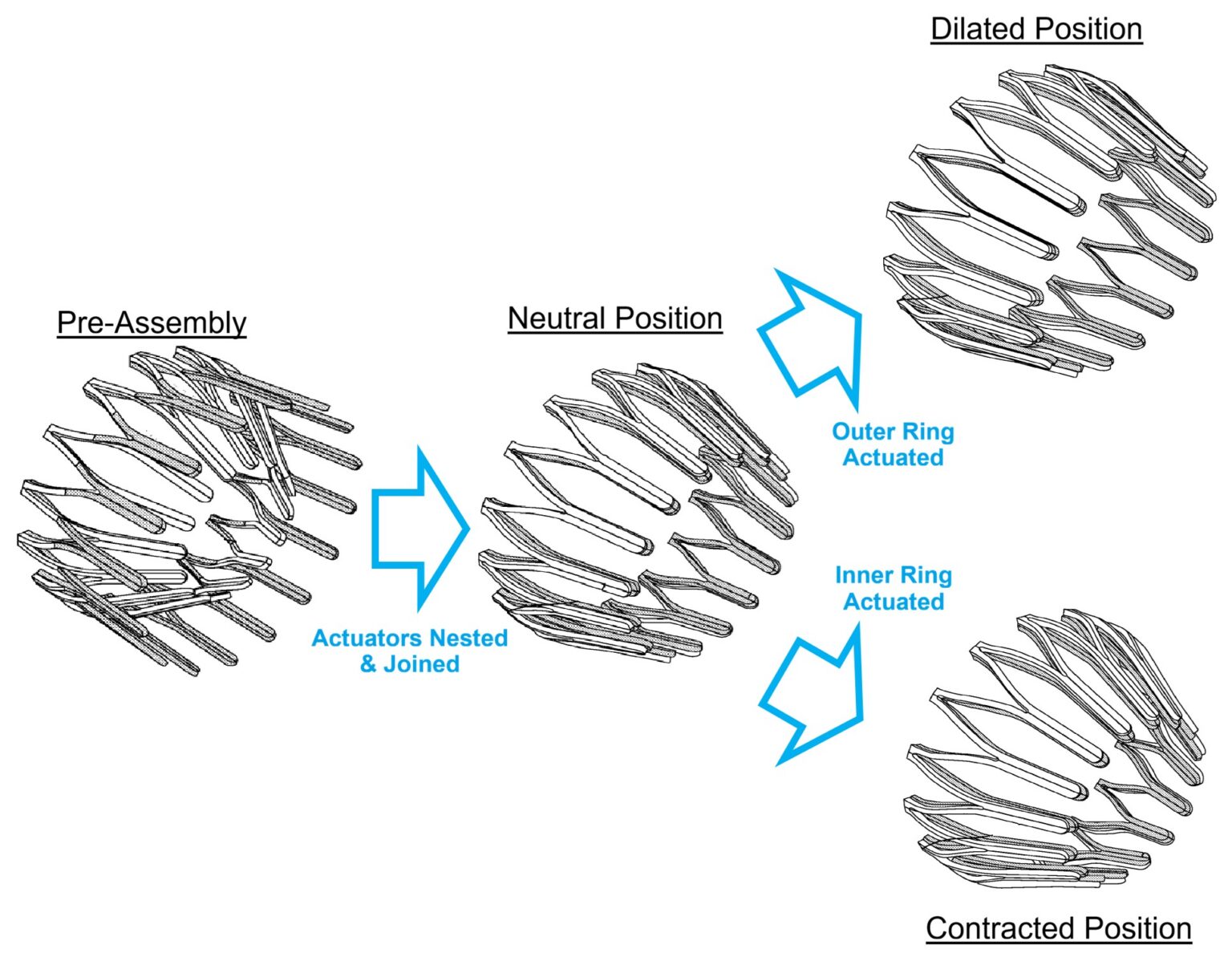 Advancements in Shape Memory Implantable Medical Devices | Driving ...